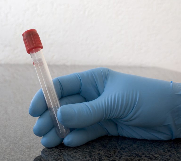 Amniotic Derived Stem Cell Therapy In California | R3 Stem Cell